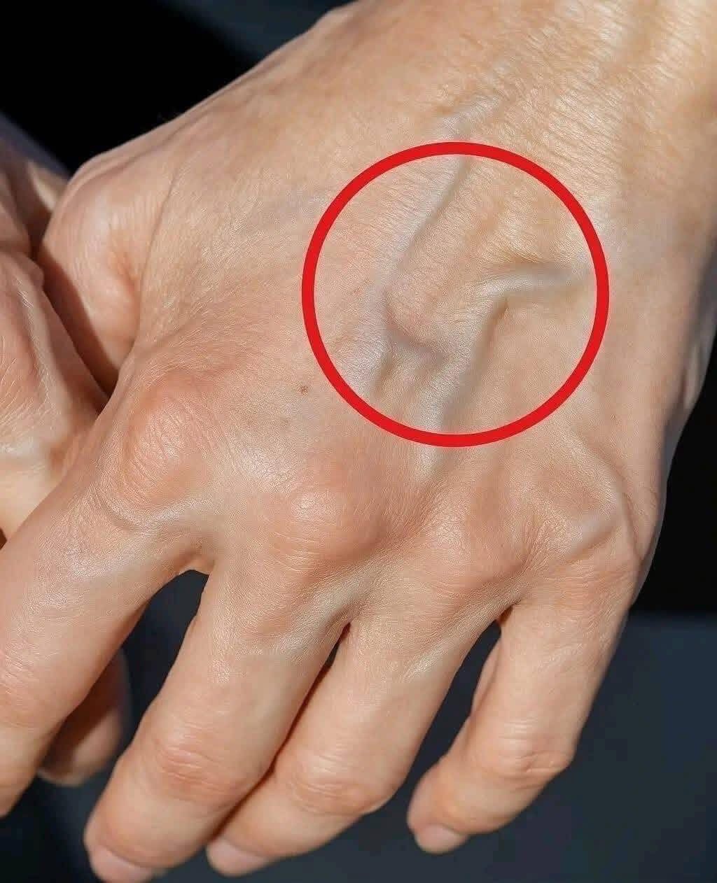 5 Health Conditions That Can Cause Visible Veins — And When to Worry ...